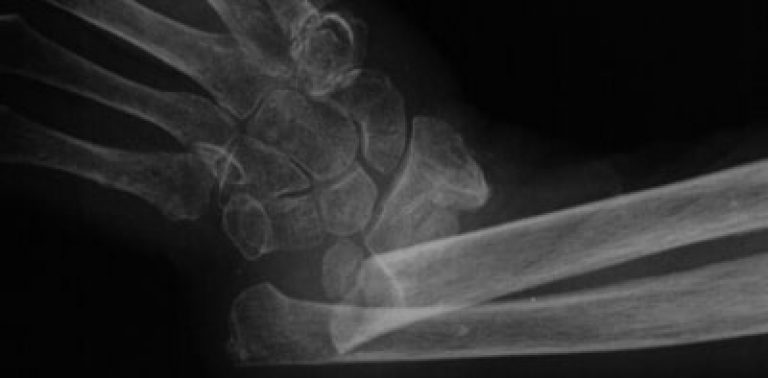 Expert Care for Hand Deformities | Hand Surgery Associates